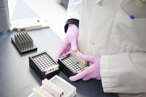 Maryland Teen Creates Test for Pancreatic Cancer | TIME.com