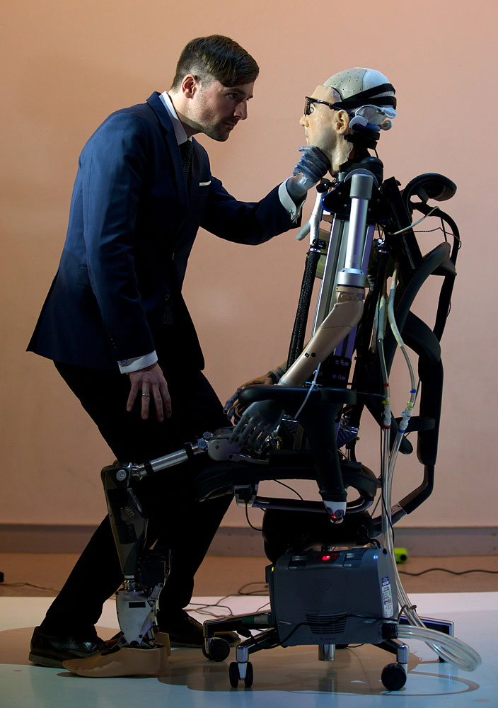 The Full Prosthetic: Bionic Man | Prosthetics Through the Years ...