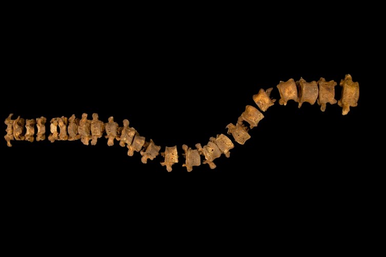 S-Shaped Spine | PHOTOS: King Richard III’s Skeleton, Dug up from ...